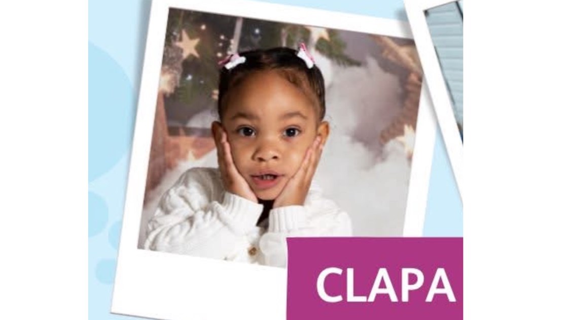 Stella Shaw is fundraising for Cleft Lip And Palate Association