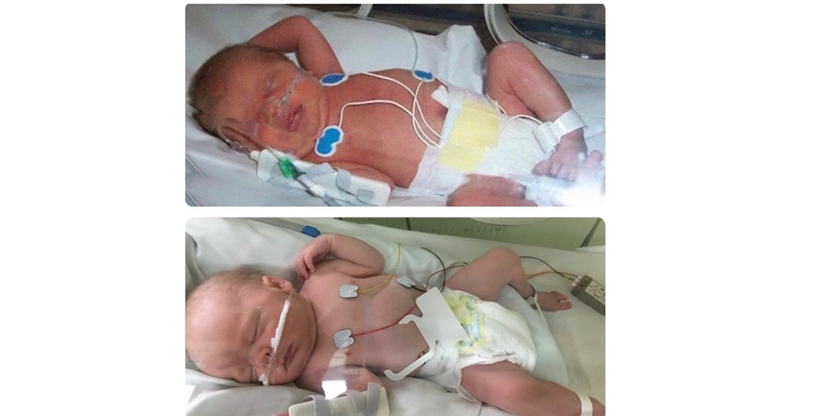 Lee Coster is fundraising for Bliss