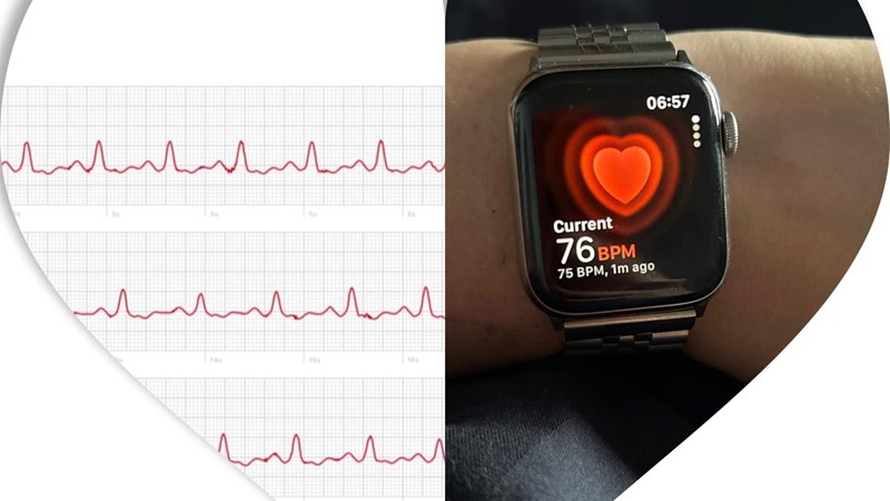 Alison Sharp is fundraising for British Heart Foundation