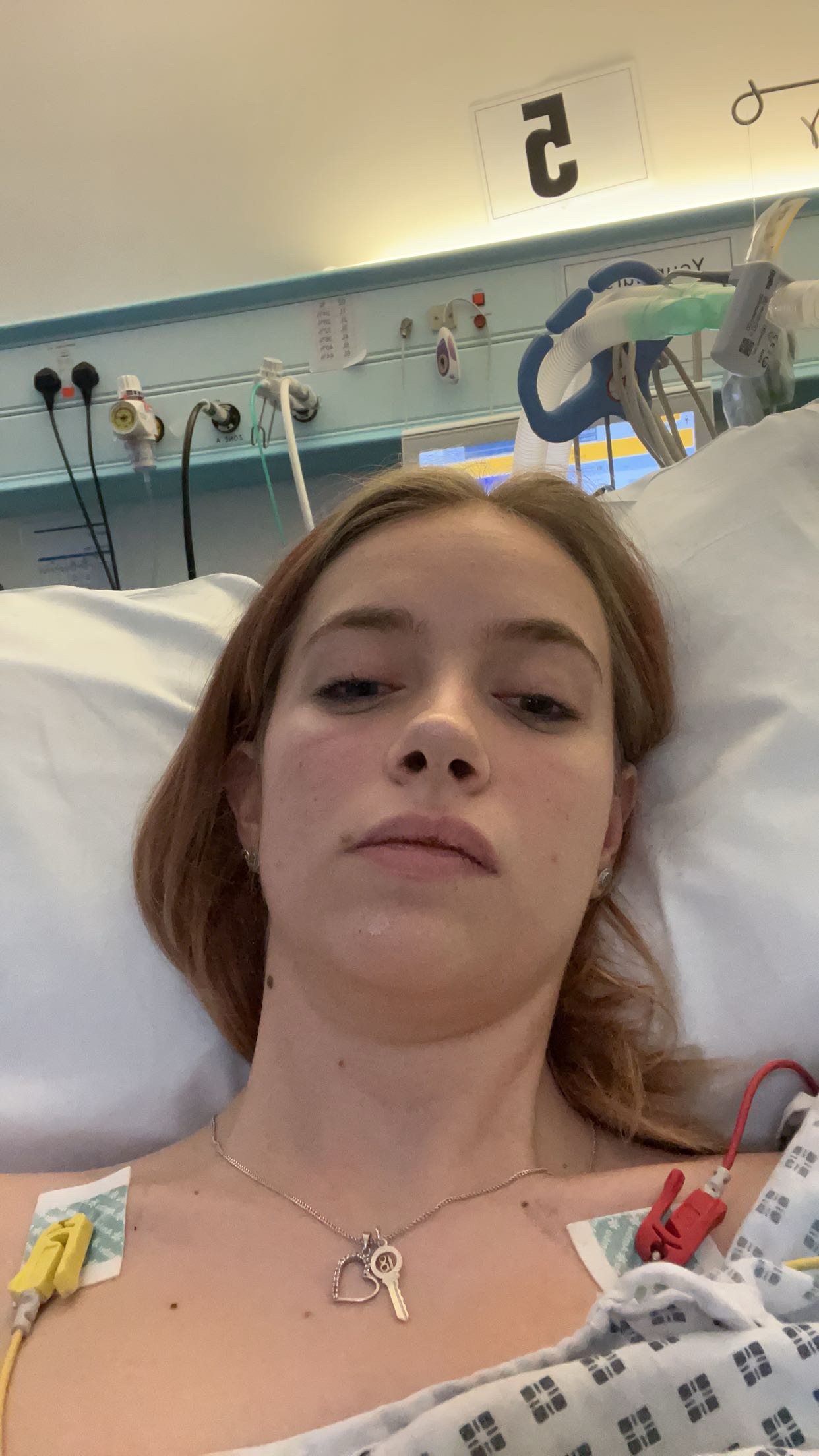 Paige Simpson is fundraising for Epilepsy Action