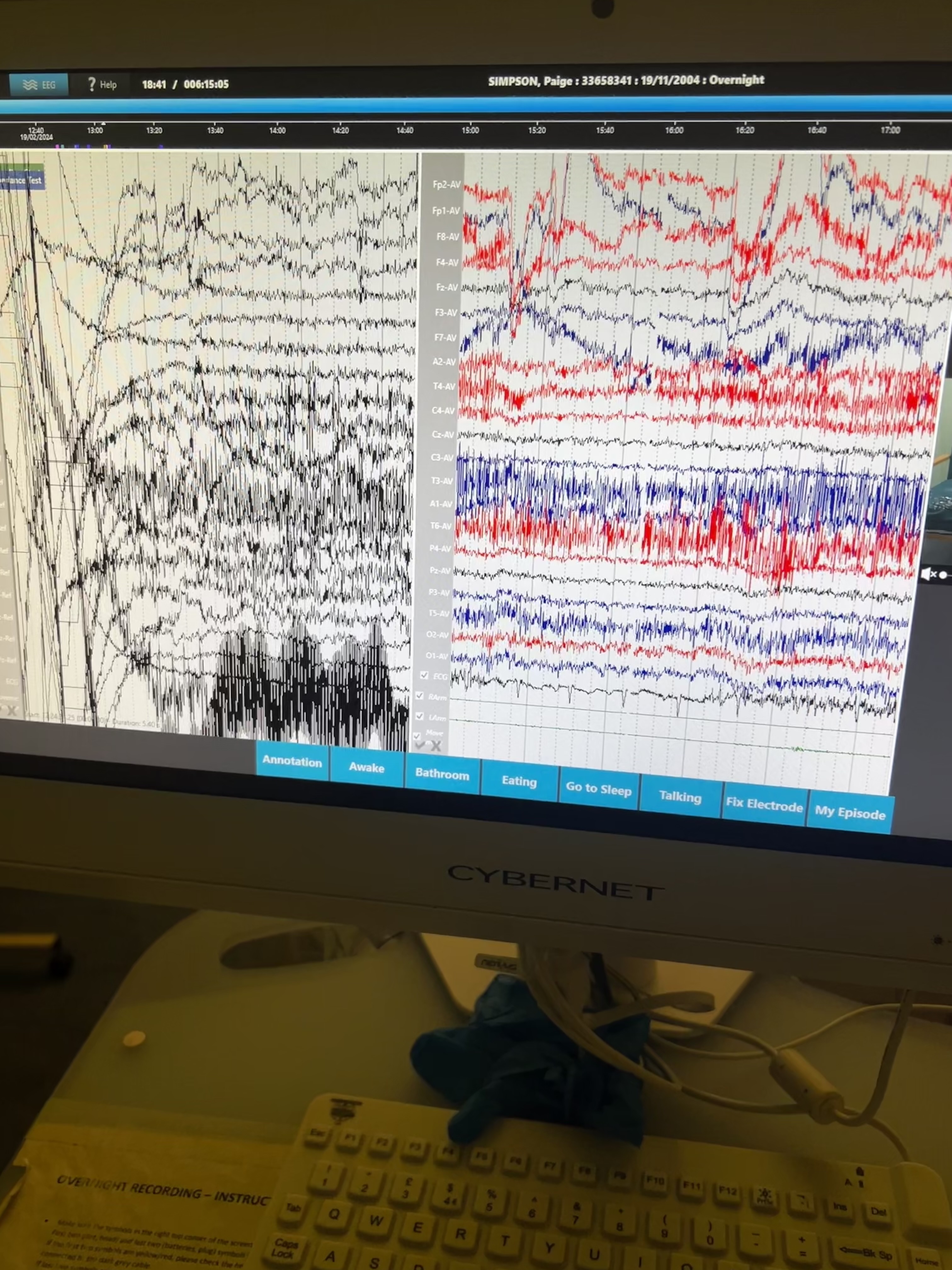 Paige Simpson is fundraising for Epilepsy Action