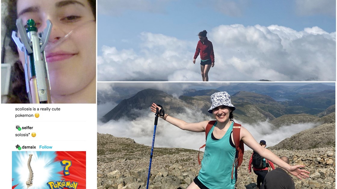 Martha Babbs is fundraising for Scoliosis Support and Research