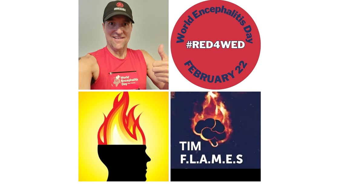 Tim Frame is fundraising for Encephalitis International