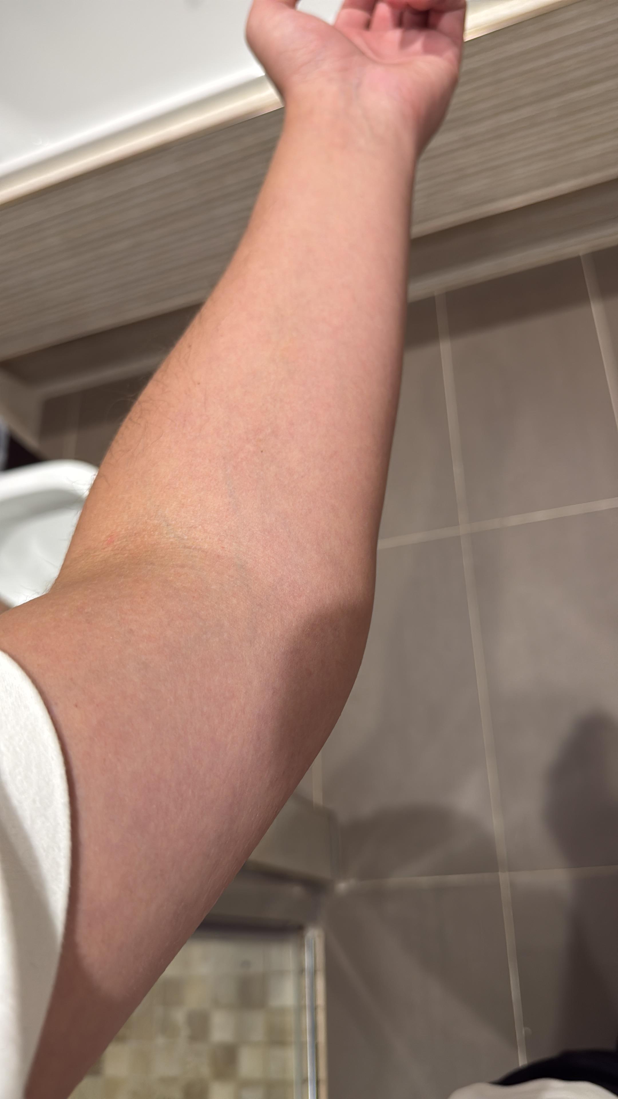 Troy Winfield is fundraising for Lymphoma Action