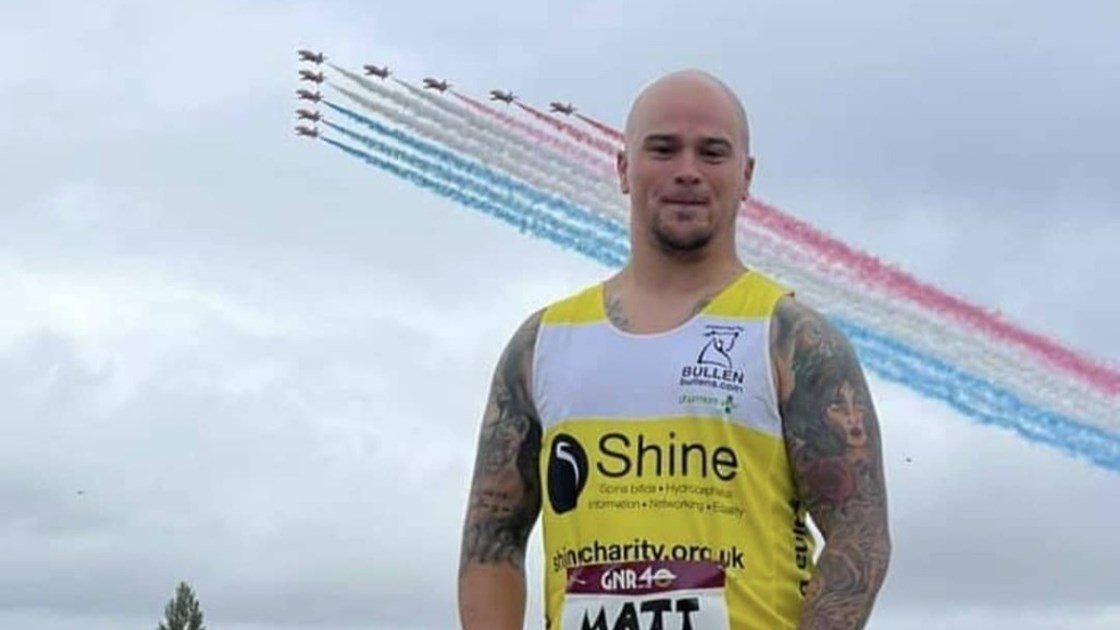 Dylan Simpson is fundraising for SHINE