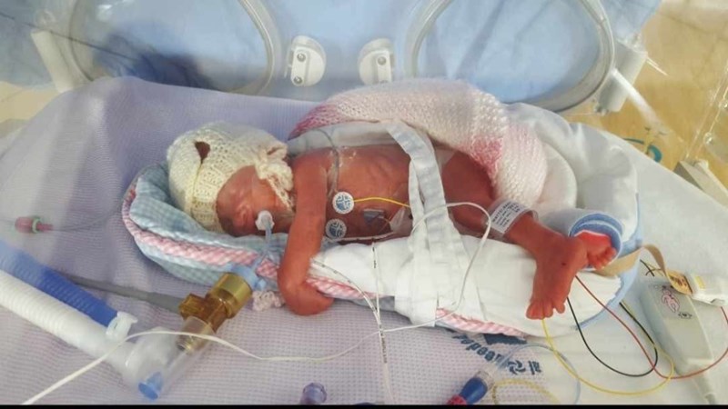 Miracle Babies - JustGiving