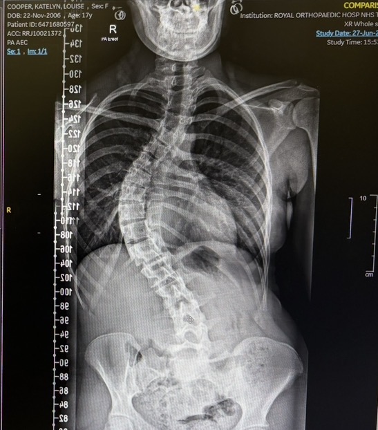 Katelyn Cooper is fundraising for Royal Orthopaedic Charity