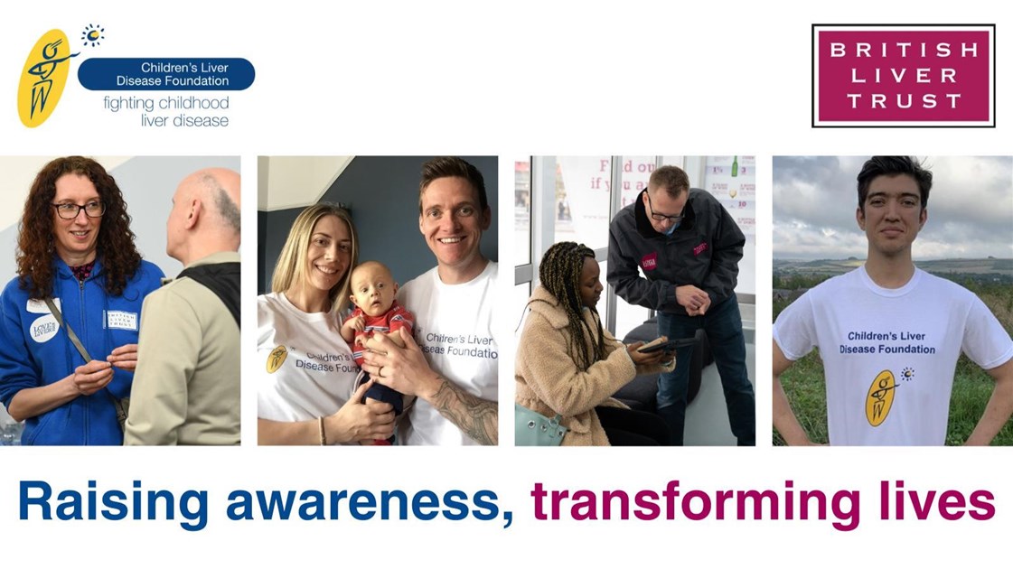 Rhodri James is fundraising for British Liver Trust