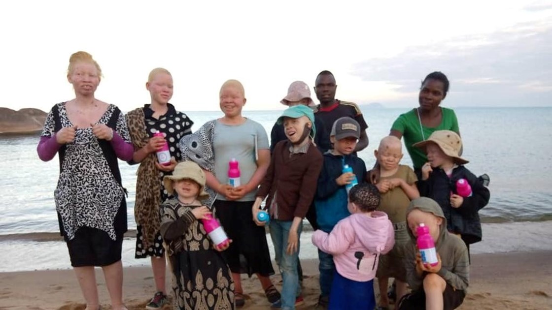 Beyond My Skin Project - JustGiving