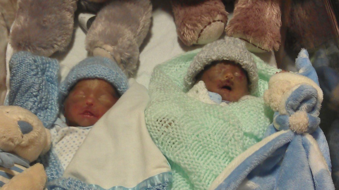 kieran moore is fundraising for Tommy’s, the pregnancy and baby charity