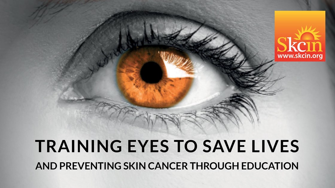 Jason Bracey is fundraising for SKCIN - The Karen Clifford Skin Cancer ...