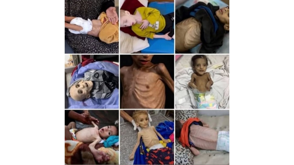 Gaza team is fundraising for AID INFINITY