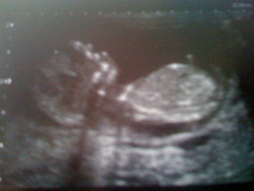 Remembering Toby Hutton